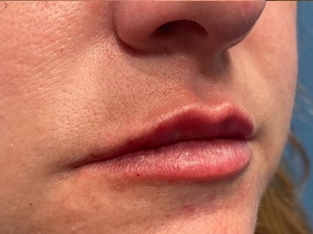 Client Results | Before & After Photos | ZO Skin Centre Dallas